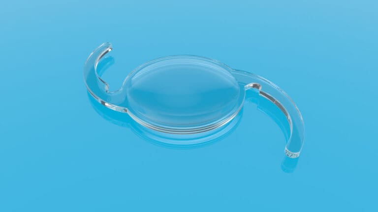 Accommodating Intraocular Lenses (IOL) | MyVision.org