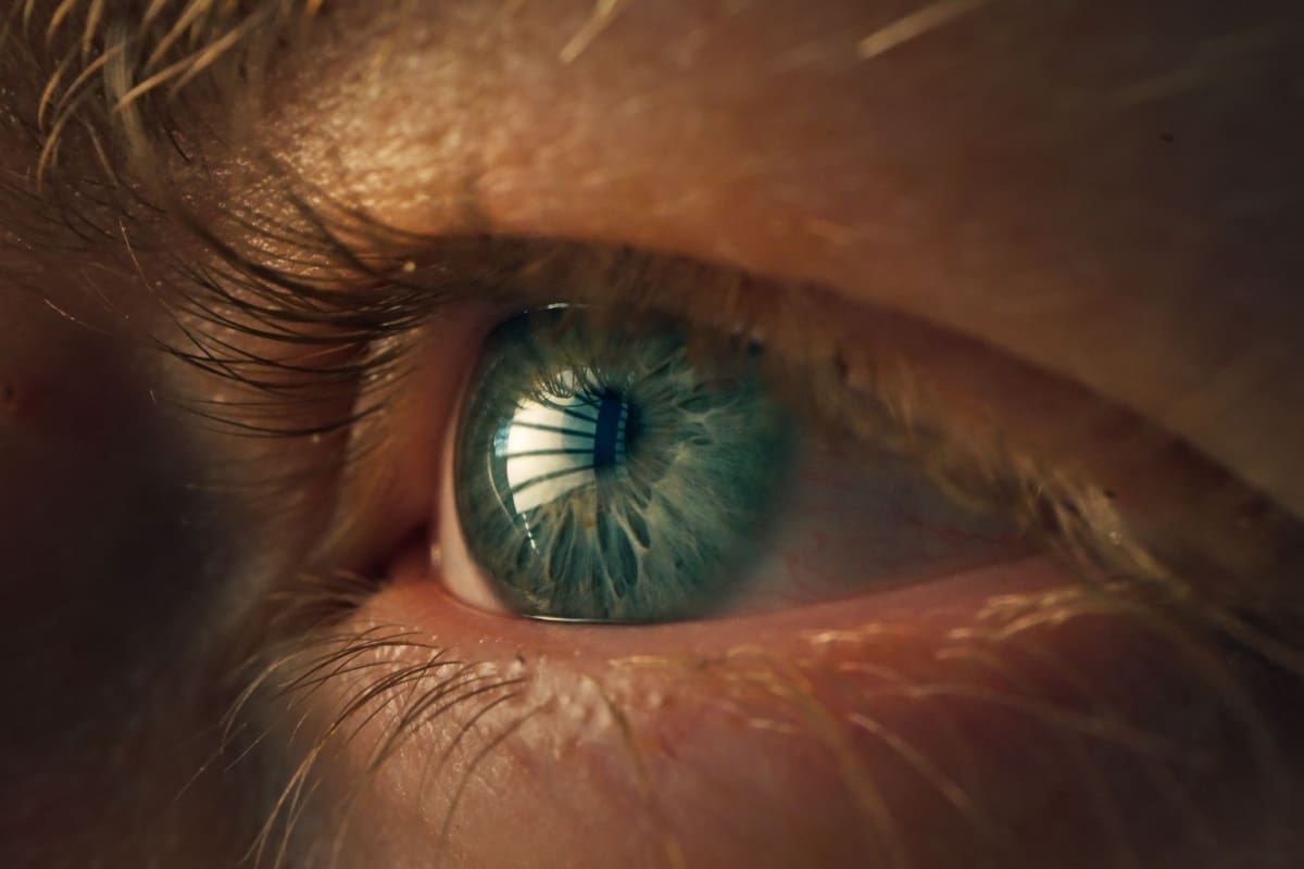 Nuclear Cataracts: Symptoms, Causes & Treatment | MyVision.org