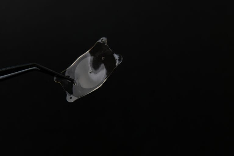 ICL Surgery: Procedure, Side Effects, Recovery and More | MyVision.org