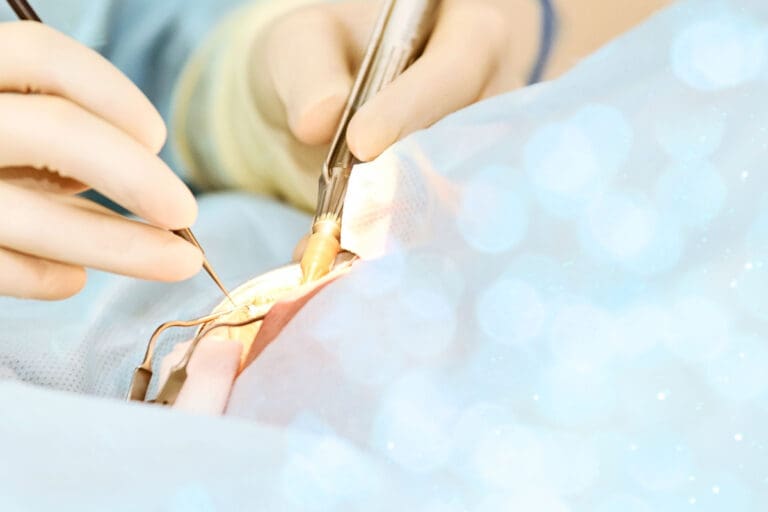 Strabismus Surgery (Eye Muscle Surgery): The Procedure, Recovery ...