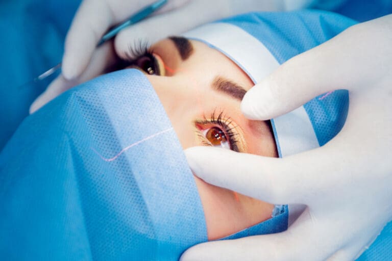 KAMRA Inlay Surgery: Pros, Cons, Costs and More | MyVision.org