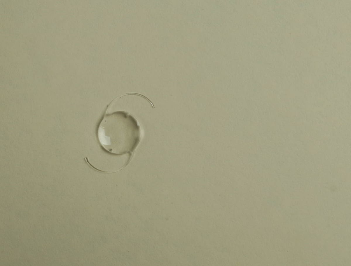 Toric IOLs (Intraocular Lenses) for Astigmatism | MyVision.org