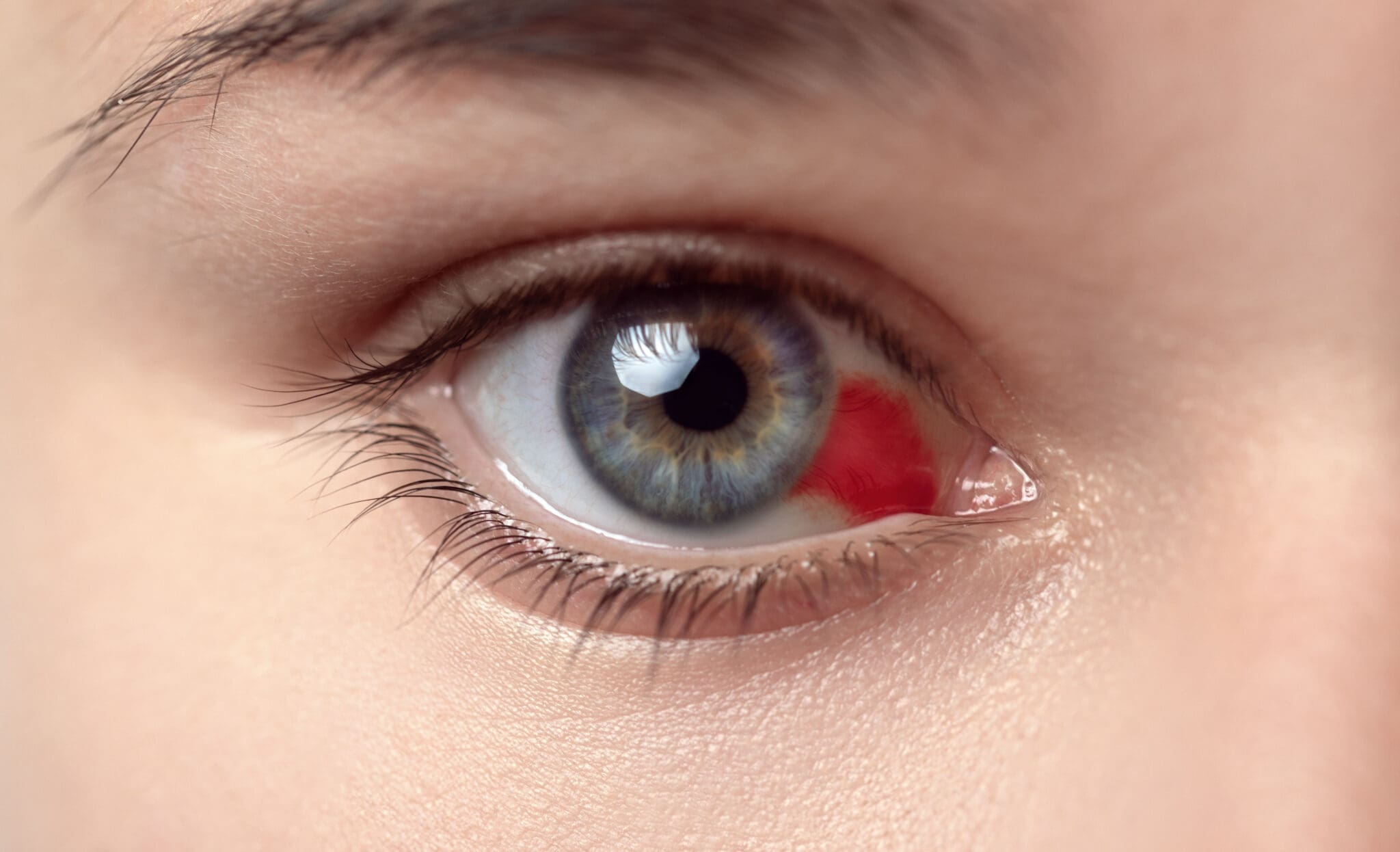 Eye Conditions & Diseases: What You Need to Know | MyVision.org
