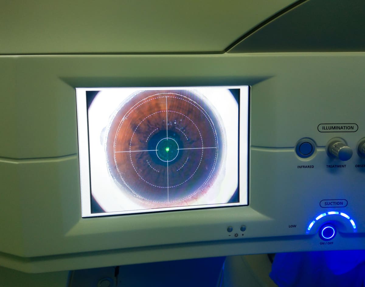 Femto LASIK: Everything You Need to Know | MyVision.org