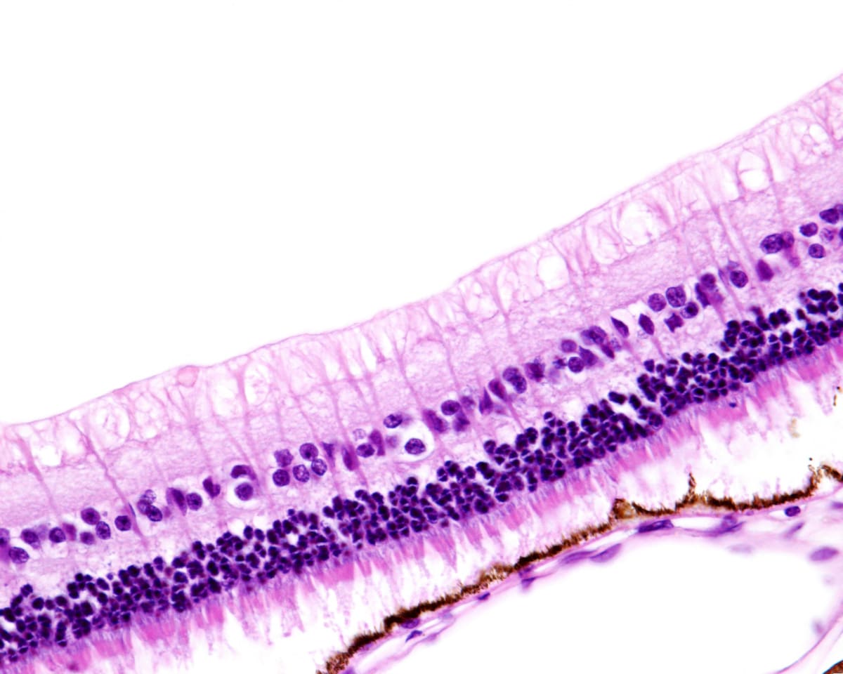 Photoreceptors: What They Are & What They Do | MyVision.org