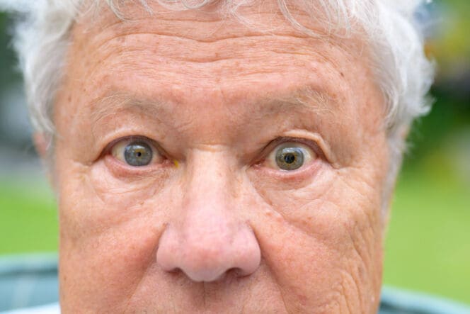 Eye Conditions & Diseases: What You Need to Know | MyVision.org